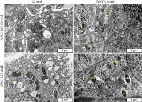 A Sa β Gal Activity Blue In Both Hipsc Rpe Control And Amd Cells