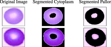 segmented results of f c means clustering algorithm download