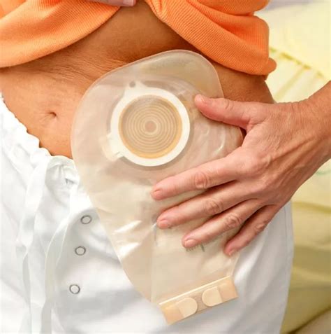 What Is Crohns Disease A Detailed Look At The Symptoms Treatment And
