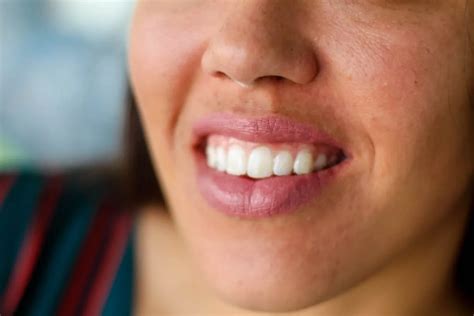 6 Reasons For The Alternative To Braces With Byte Aligners