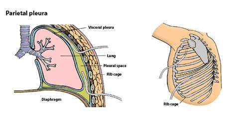 Ceufast Chest Tube Drainage Systems