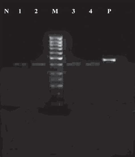 Alu I Generated Pcr Rflp Pattern Of N Gene Sequence Approximately 463 Download Scientific
