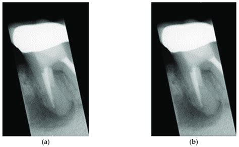 The Results Of The Gaussian High Pass Filter A Original Apical Download Scientific Diagram