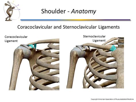 Prolotherapy For Shoulder At Ross Brown Blog