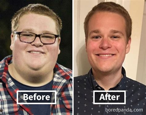 128 Surprising Photos Of Face Fat Loss Before And After Weight Loss