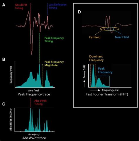 A Novel Automated Peak Frequency Annotation Algorithm For Identifying