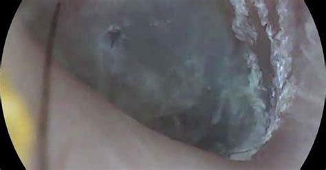 Good And Bad Ear Drum Album On Imgur