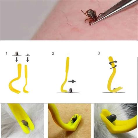 Set Of Tools To Remove Flea Petpixies