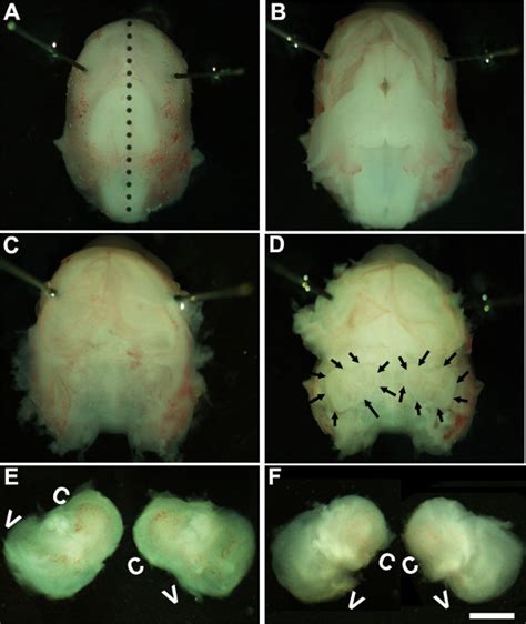 Culture Of Embryonic Mouse Cochlear Explants And Gene Transfer By Electroporation