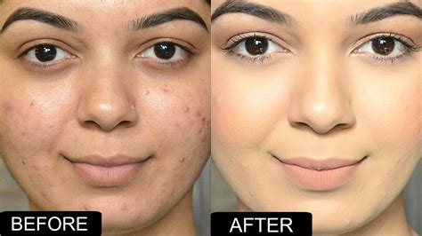 What Is The Best Makeup For Skin With Large Pores Saubhaya Makeup