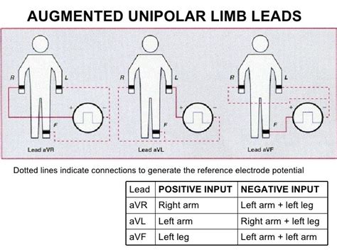 ecg lecture