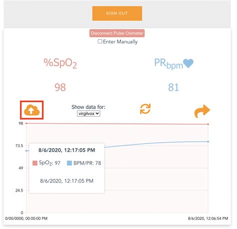 Building A Pulse Oximetry Tracker Using Aws Amplify And Aws Serverless