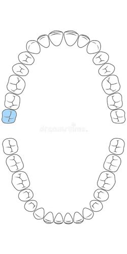 Tooth Numbering Universal Numbering System Flashcards Quizlet