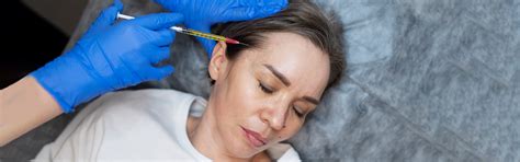Botox For Migraines How It Works And Its Effectiveness