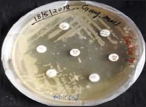 Antibiotic Sensitivity Patterns Showing The Sensitivity To The B Download Scientific Diagram