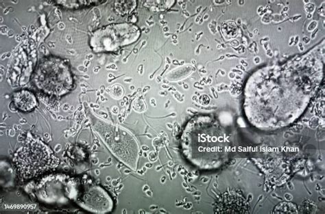 박테리아 고름 세포 상피 세포 및 정자를 보여주는 현미경 소변 검사 배율에 대한 스톡 사진 및 기타 이미지 배율 미생물학 생물학 Istock