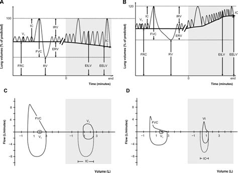 Pathogenesis Of Hyperinflation In Chronic Obstructive Pulmonary Disease Pmc