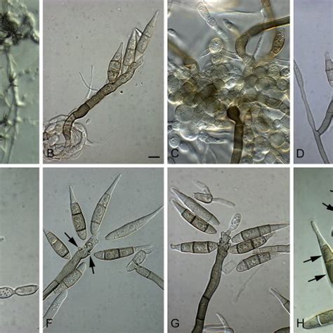 Resolving The Polyphyletic Nature Of Pyricularia Pyriculariaceae