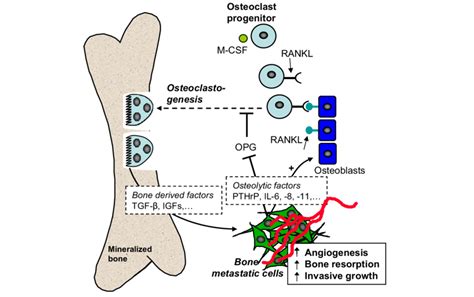 The Vicious Cycle Of The Osteolytic Bone Metastasis Release Of Download Scientific Diagram