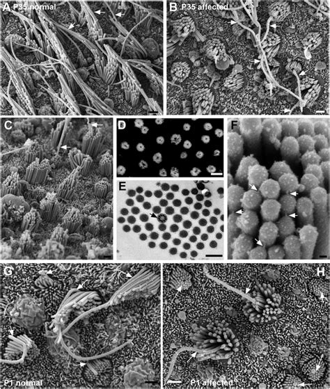 Utricular Macula A Normal Aged P35 Stereociliary Bundles Are
