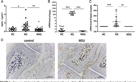 Figure 1 From Leptin Promotes Monosodium Urate Crystal Induced Inflammation In Human And Murine