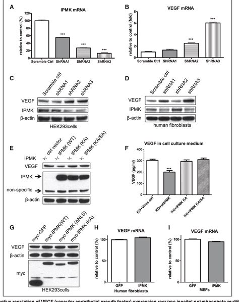 Figure 1 From Inositol Polyphosphate Multikinase Inhibits Angiogenesis Via Inositol