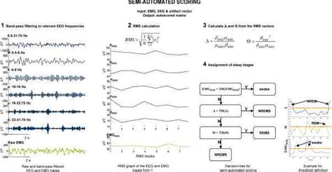 In The Semi Automated Sleep Scoring Routine Following Steps Are