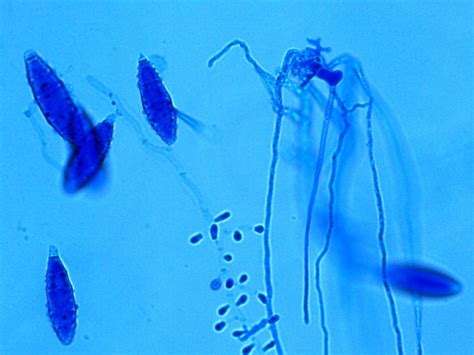 Fun With Microbiology Whats Buggin You Microsporum Gypseum Fun With Microbiology Whats Buggin You Microsporum Gypseum