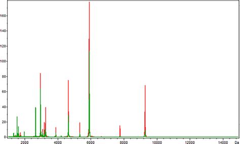 Preoperative Red And Postoperative Green Serum Protein Fingerprints Download Scientific