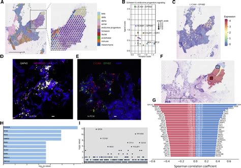 人类胰腺单细胞图谱与空间景观 知乎