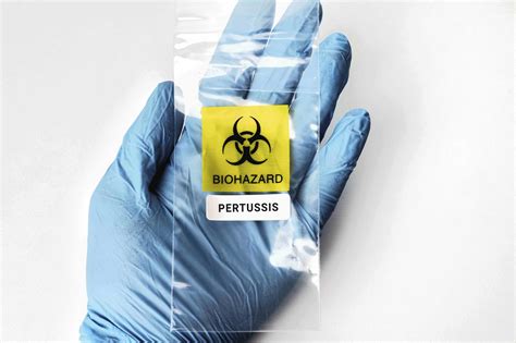 What Is Pertussis Alert Issued For Disease Outbreak Across Sa