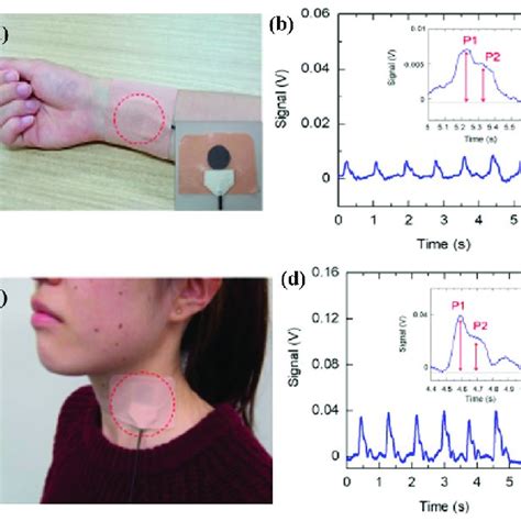 A Three Electrode Circuit System For Wearable Amperometric Download Scientific Diagram