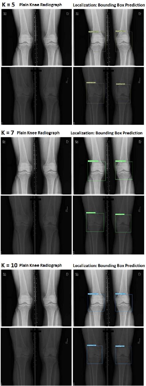Figure 3 From Enforcing Explainable Deep Few Shot Learning To Analyze Plain Knee Radiographs