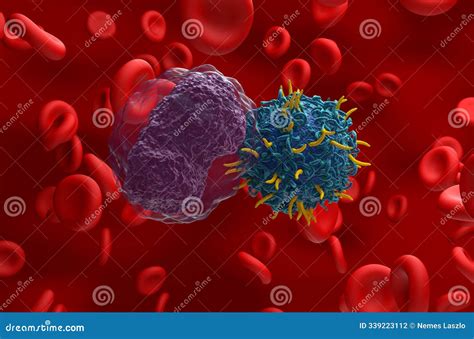 Non Hodgkin Is Lymphoma In Lymph Node Stock Image