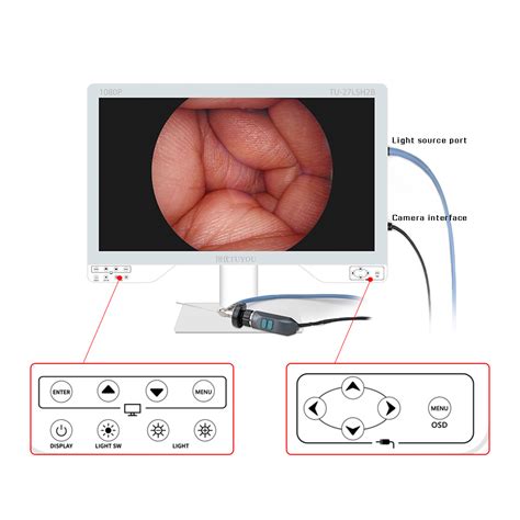 Medical Full Hd Endoscope Led Cold Light Source For Medical Laparoscopy