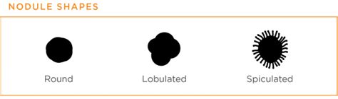 Lung Nodules Lungevity Foundation