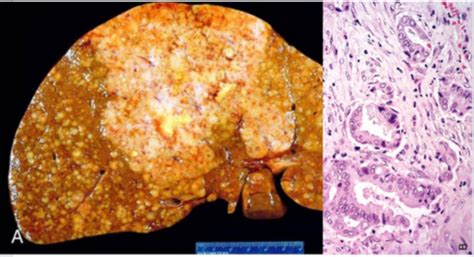 Liver Histo Flashcards Quizlet