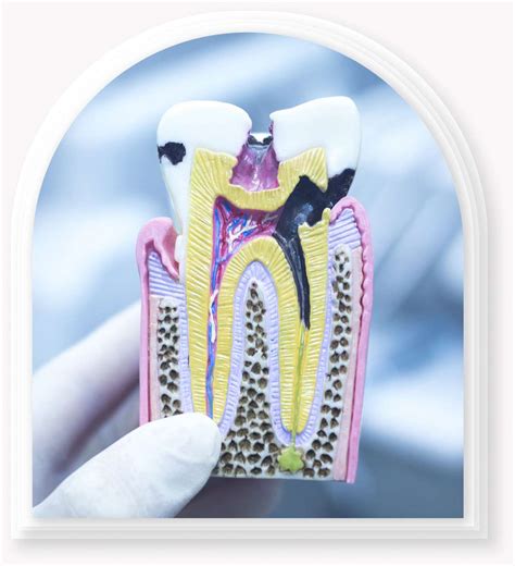 Gum Disease Treatment Warrnambool Smile Dental