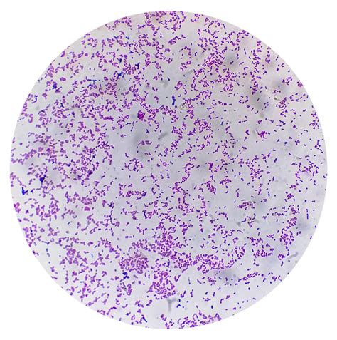 Gram Stain Staphylococcus Aureus