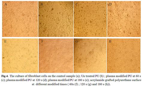 Surface Modification Of Polyurethane With Acrylamide By Plasma