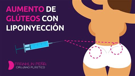 Gluteos Inyectados