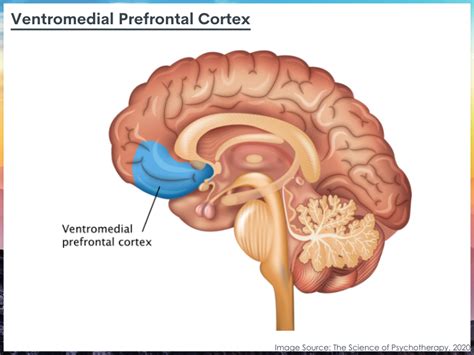 Sex Specific Brain Connectivity During Early Abstinence Implications For Anxiety Stress And