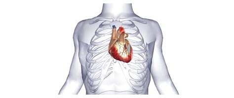 Implantable Loop Recorder One Heart Cardiology
