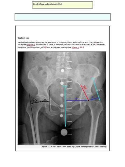 Depth Of Cup And Acetabular Offset Pdf Musculoskeletal System