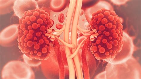 Uremia Definition Causes Symptoms And Treatments Scope Heal