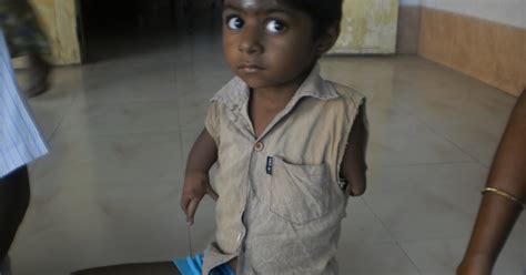 வ சூல் ராஜா எம்பிபிஎஸ் எம் டி Seal Limb