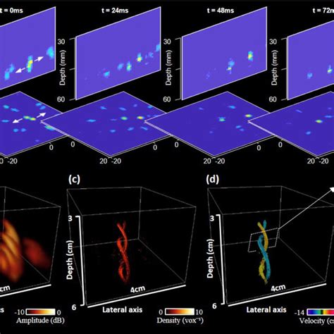 Ultrasound Localization Microscopy Ulm Of A Tube Using The 4λ Matrix Download Scientific