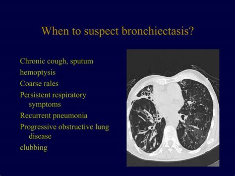 Ppt Bronchiectasis Powerpoint Presentation Id1426050