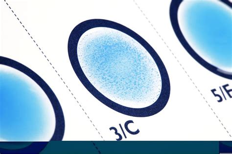 Streptococcus Grouping Test Photograph By Science Photo Library Fine