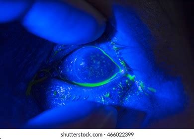 Close Fluorescence Stain On Spk Ekc Stock Photo 466022399 Shutterstock